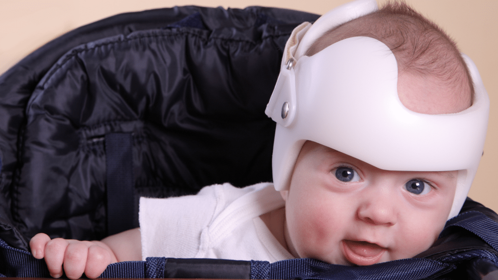 Babies’ Head Shapes: When to Worry and What to Do - Rich Single Momma